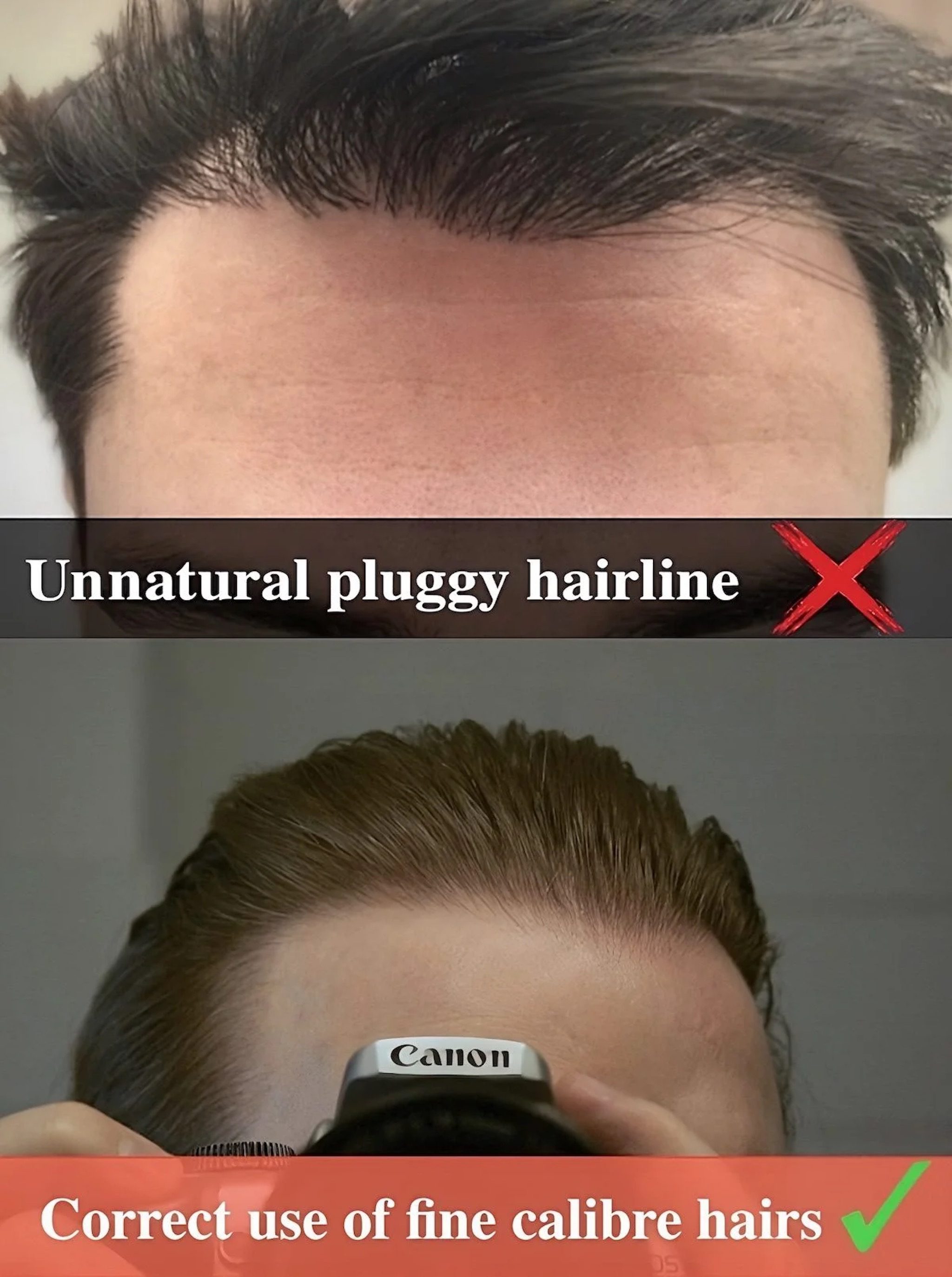 WMG Soft Natural Hairline | Westminster Medical Group